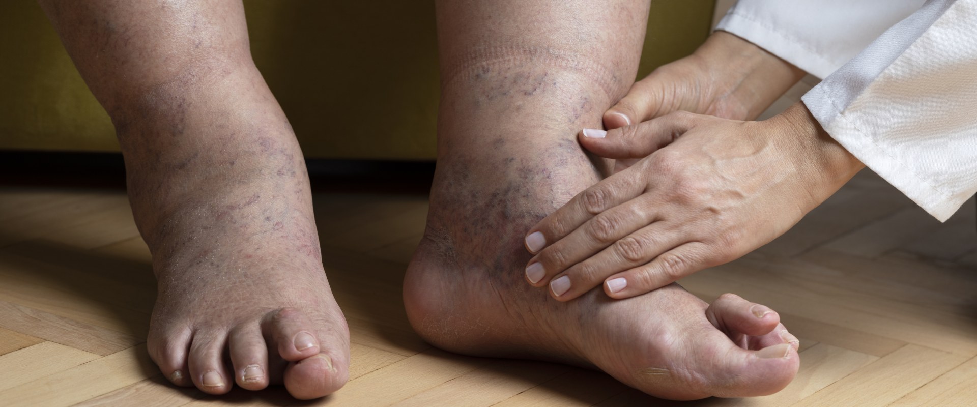 What is the new treatment for neuropathy in legs and feet?